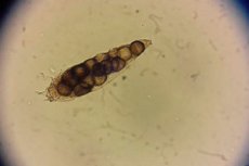 Demodex-Milbe: Symptome, Diagnose und moderne Behandlung der Demodikose ...